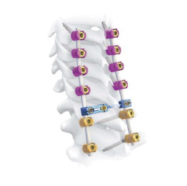 Advanced Technology & Implants For Spine Surgery | Spinal Elements
