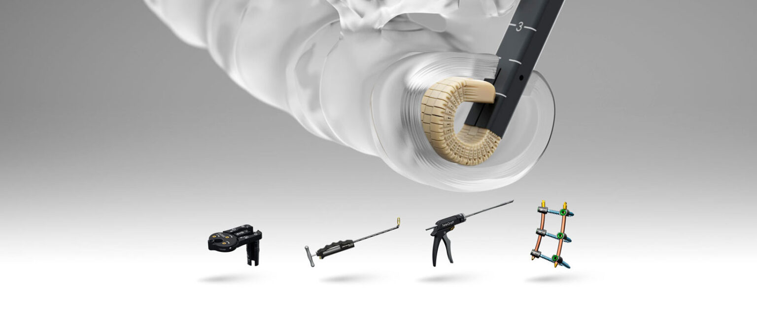 Innovative Spine Surgery Solutions