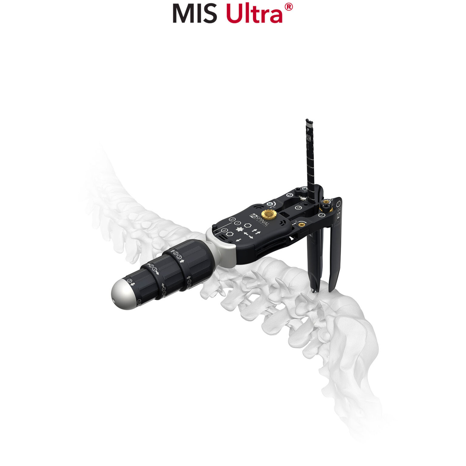 Lateral Lumbar Interbody Fusion (LLIF) Solutions