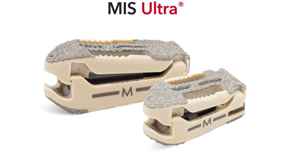 Thoracolumbar Interbody Fusion | Technology For Spinal Surgeries