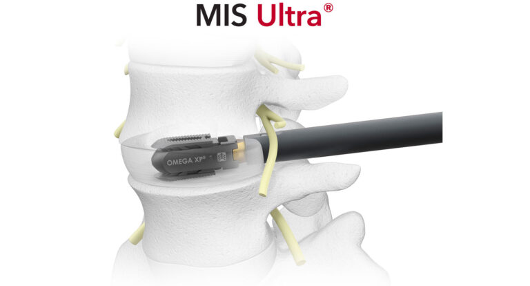 MIS Ultra® - Spinal Elements