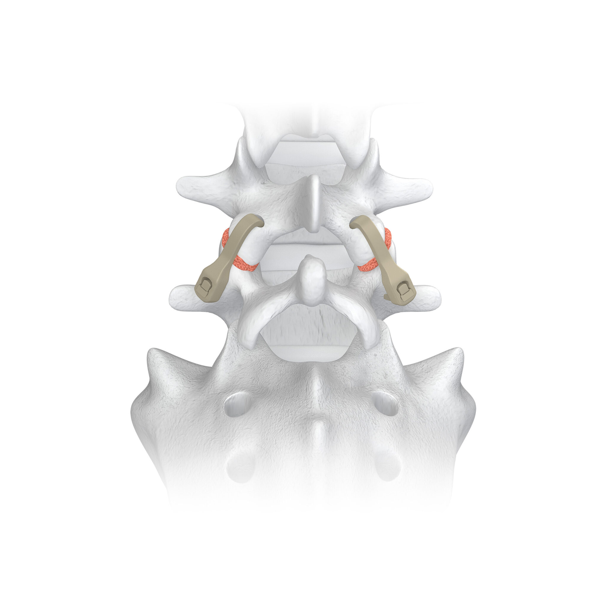 Newsroom - Spinal Elements