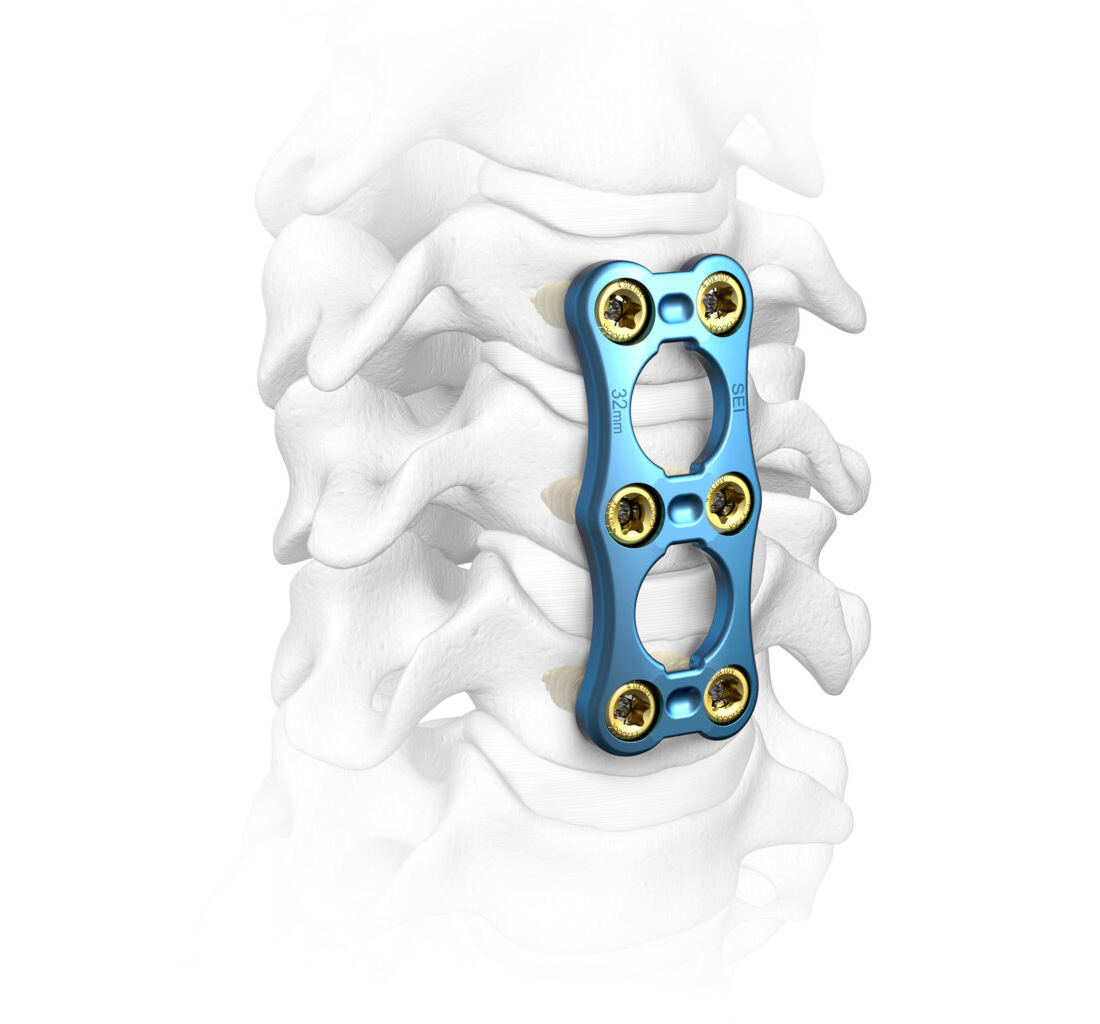 Transforaminal Lumbar Interbody Fusion (TLIF) Solutions